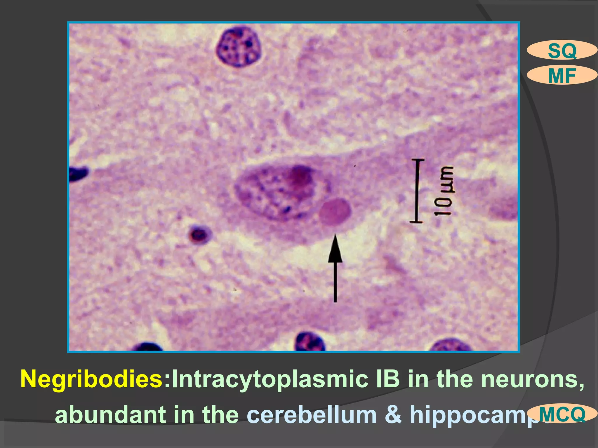 Inclusion bodies | PPT