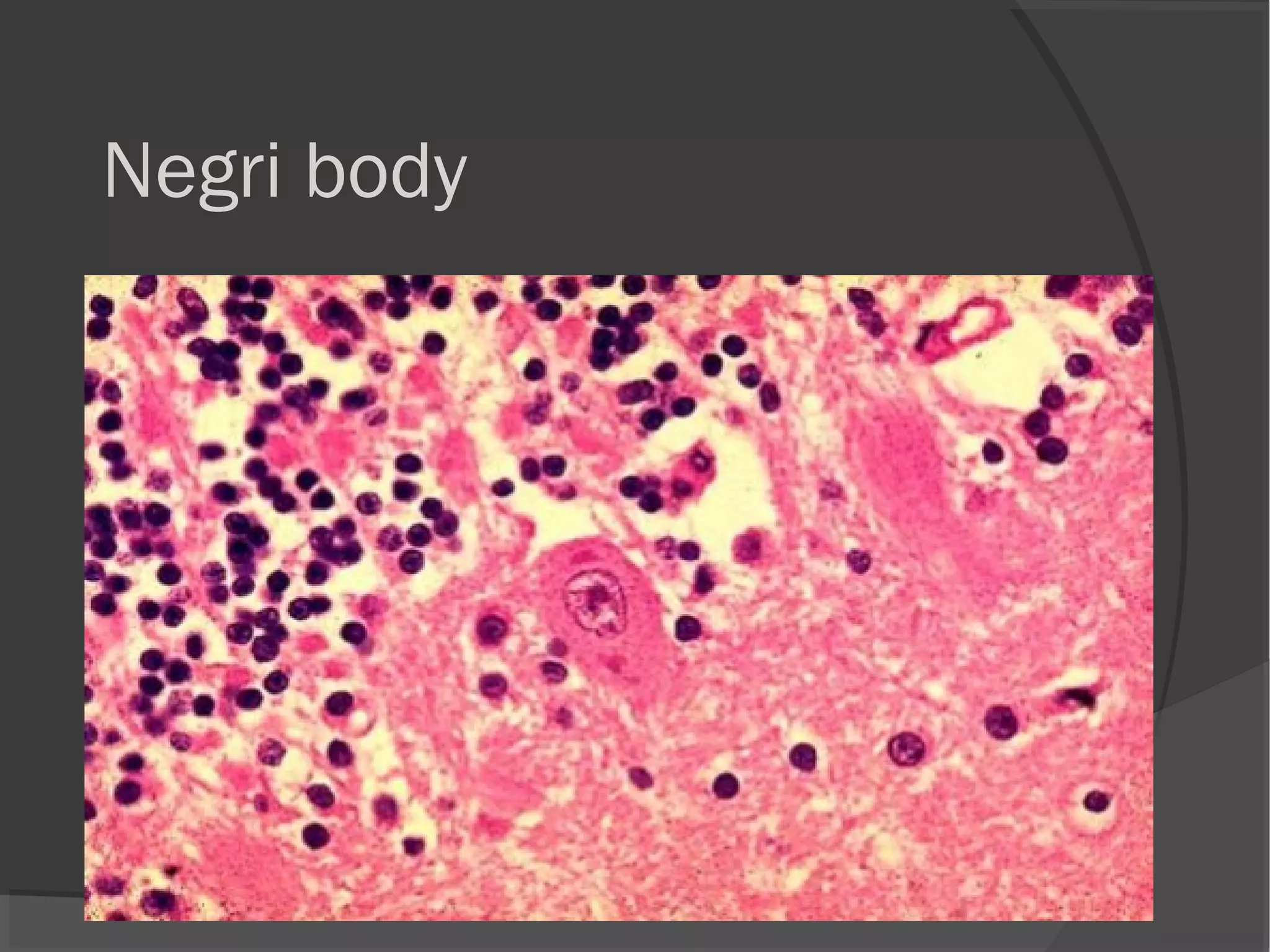 Inclusion bodies | PPT