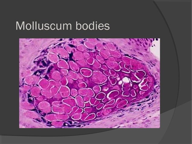 Inclusion bodies | PPT