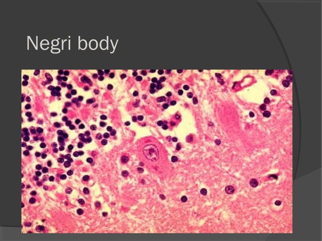 Inclusion bodies | PPT