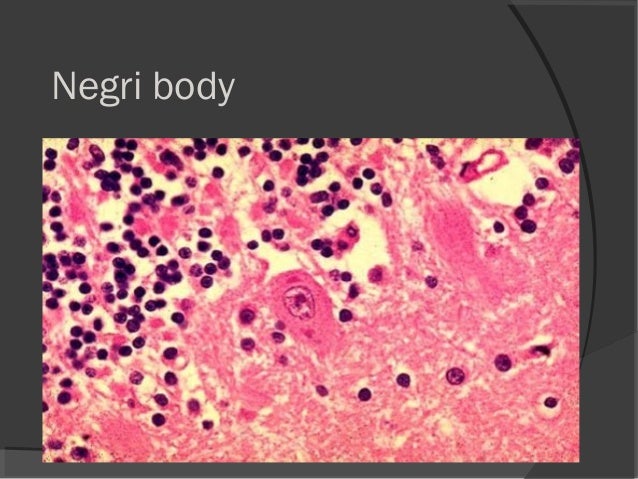Inclusion Bodies