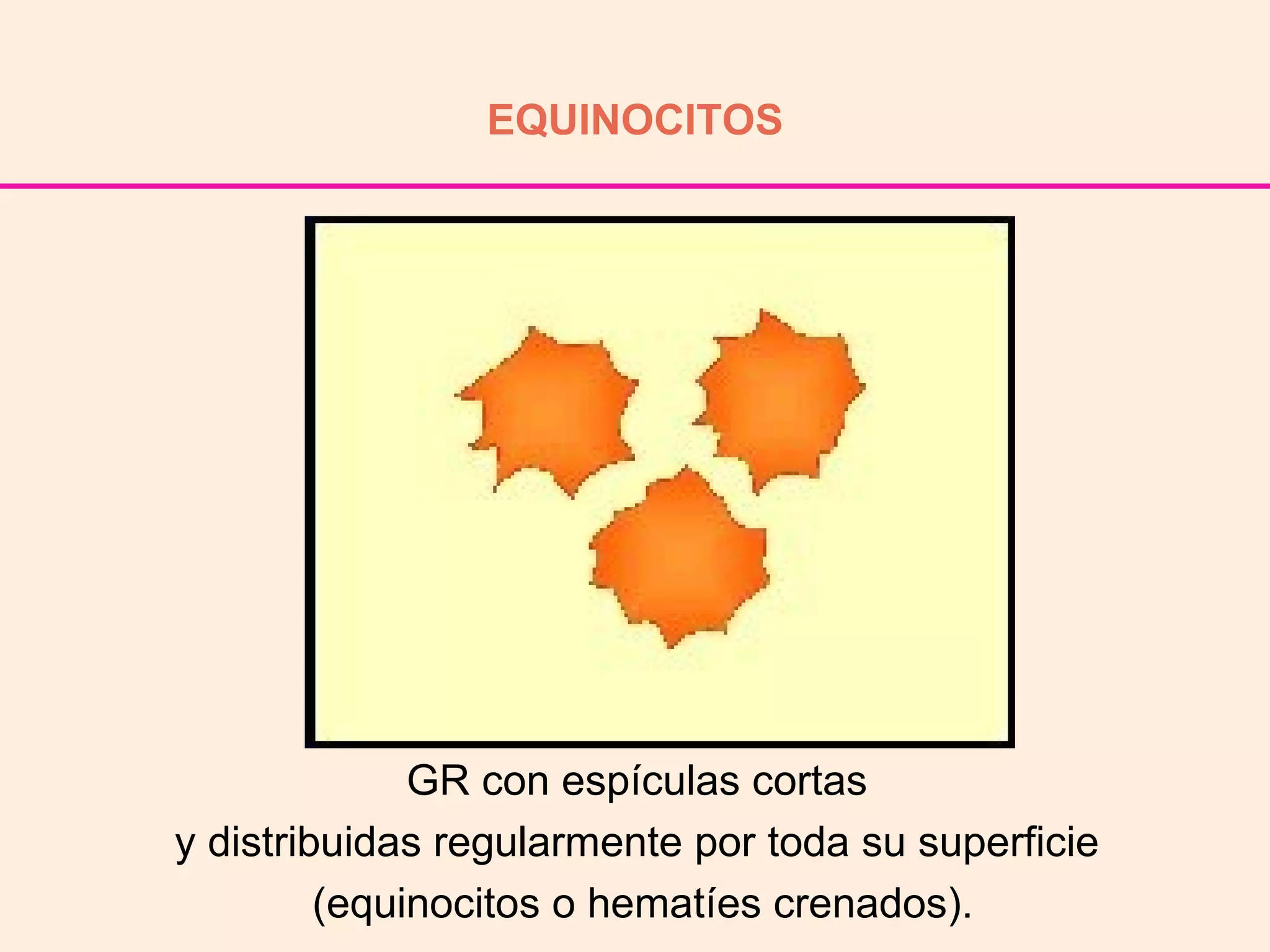 Inclusiones citoplasmaticas y alteraciones morfologicas | PPT | Blood ...