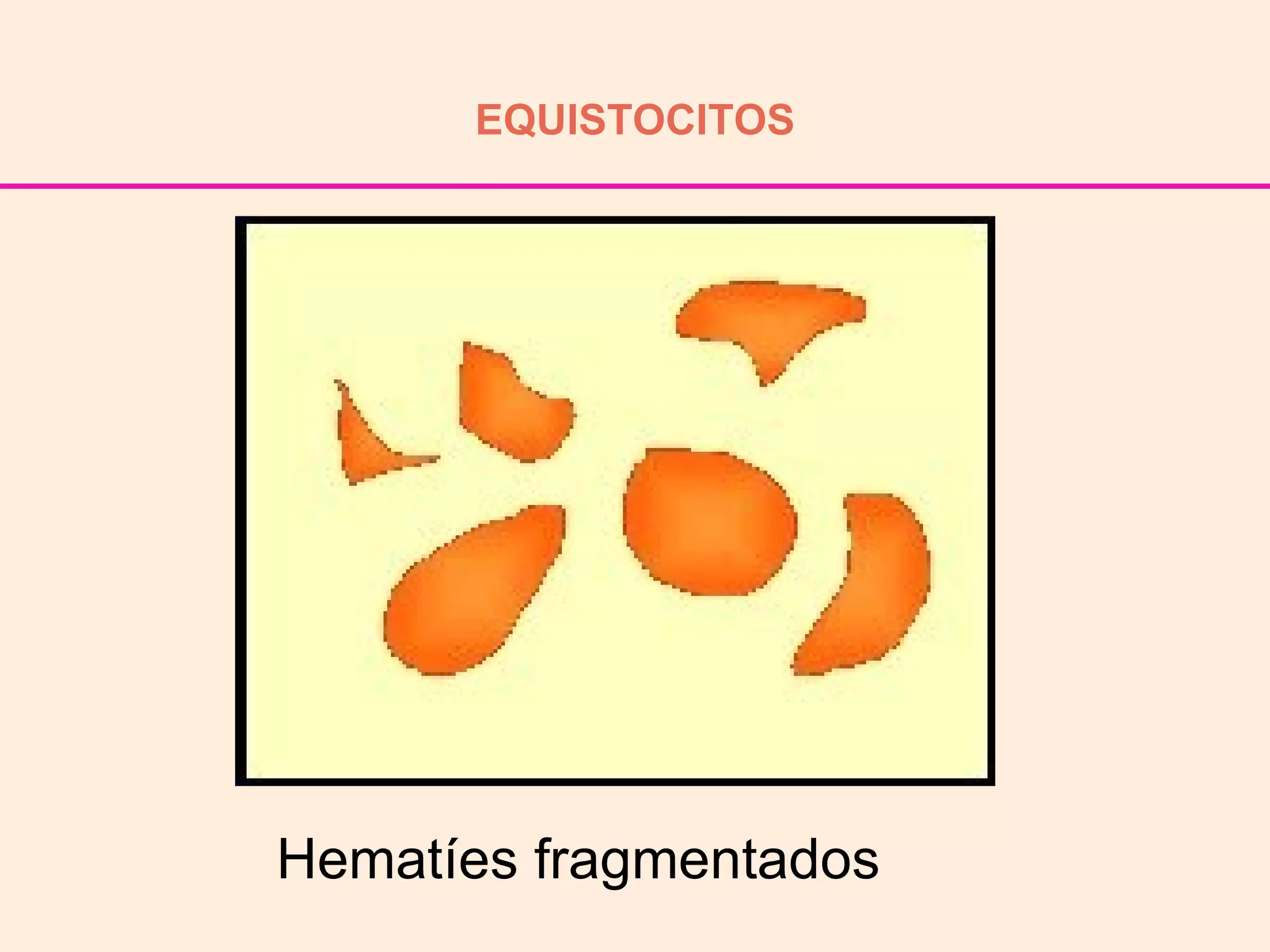 Inclusiones citoplasmaticas y alteraciones morfologicas | PPT
