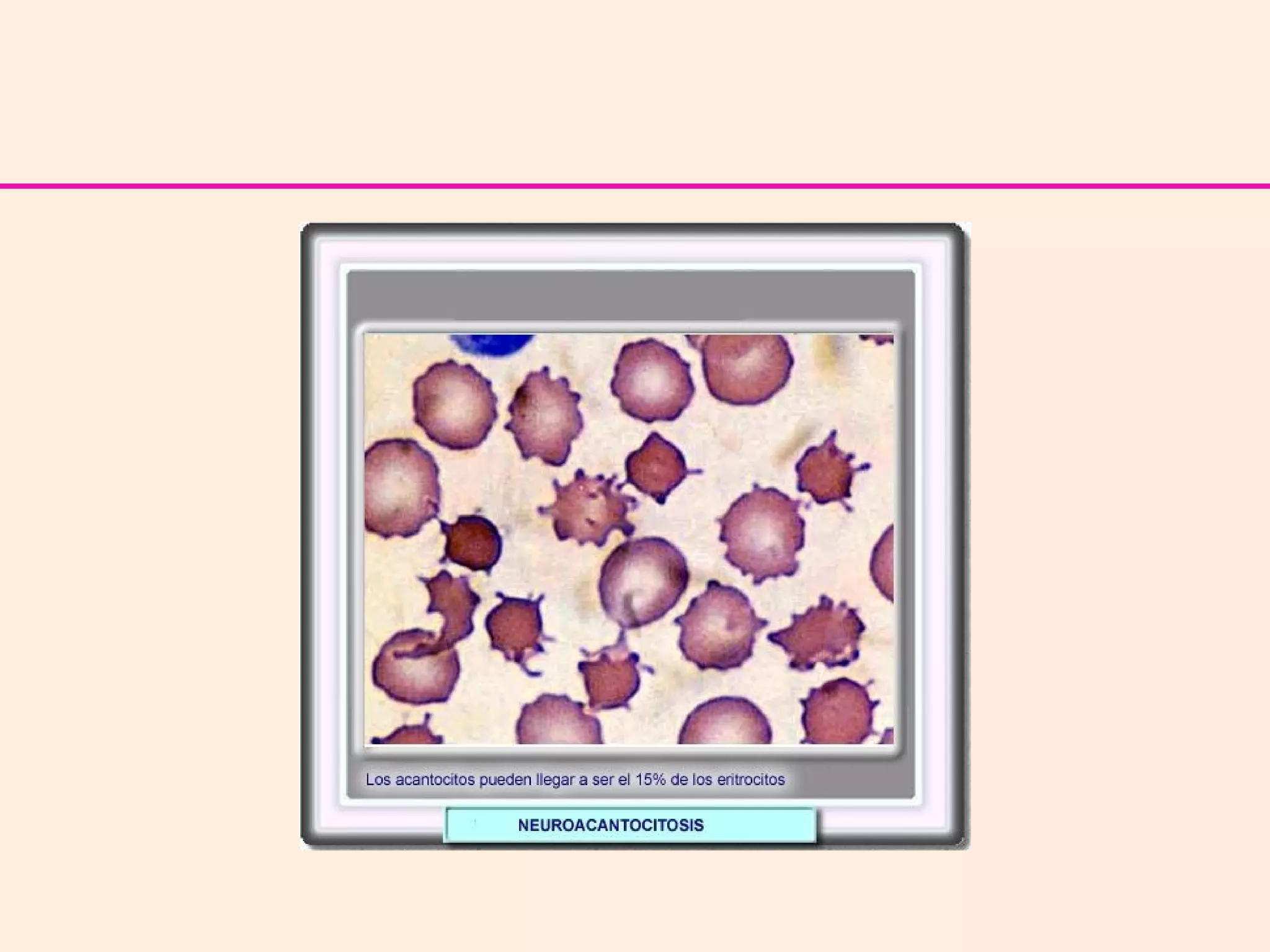Inclusiones citoplasmaticas y alteraciones morfologicas | PPT | Blood ...
