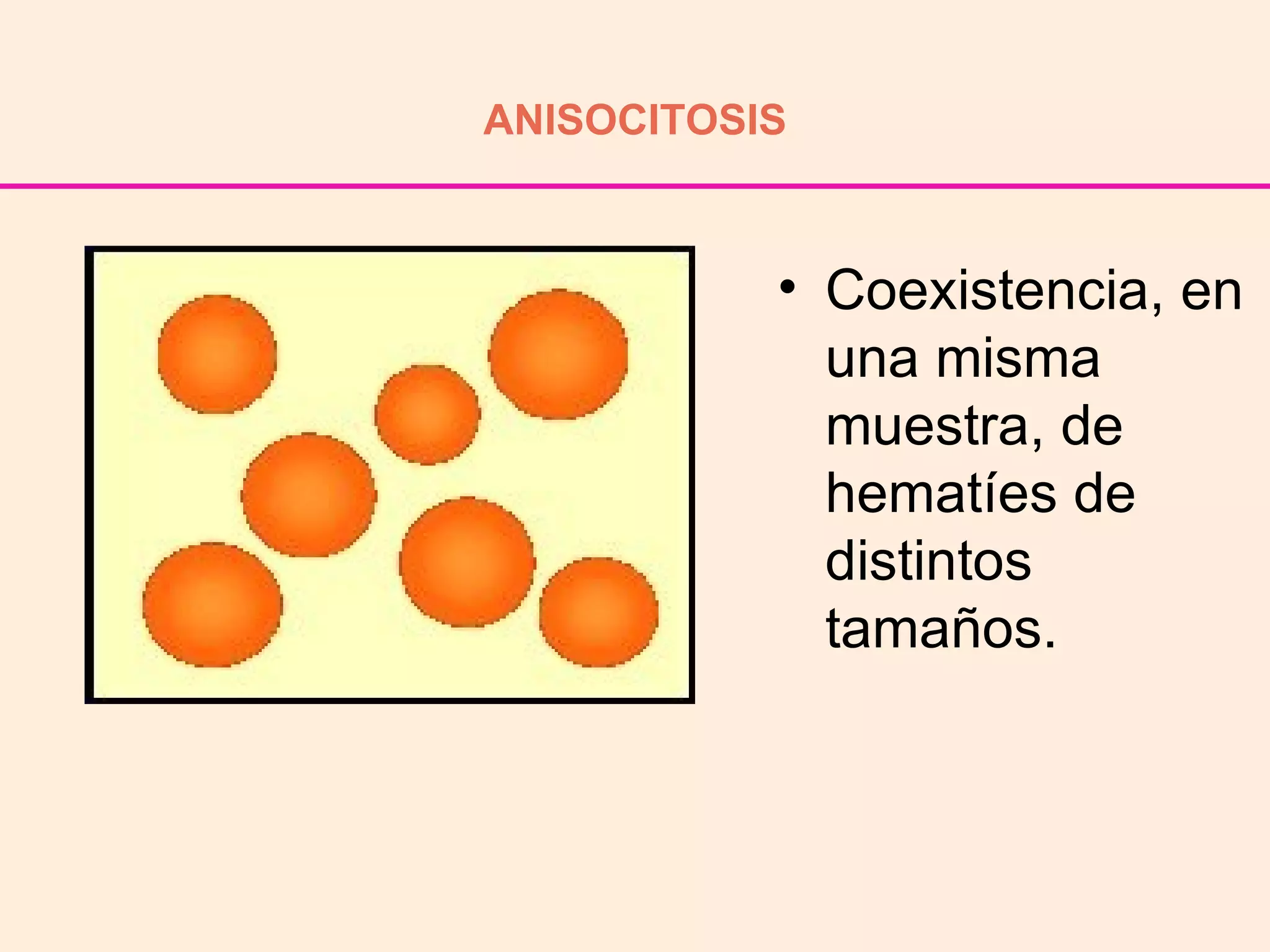 Inclusiones citoplasmaticas y alteraciones morfologicas | PPT | Blood ...