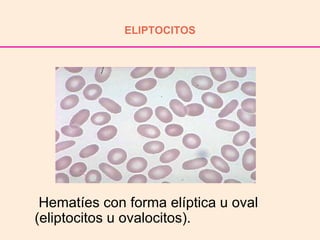 Inclusiones citoplasmaticas y alteraciones morfologicas | PPT
