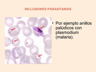 Inclusiones citoplasmaticas y alteraciones morfologicas | PPT