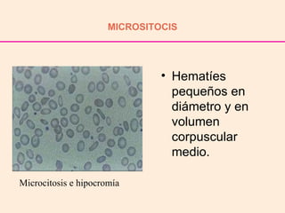 Inclusiones citoplasmaticas y alteraciones morfologicas | PPT