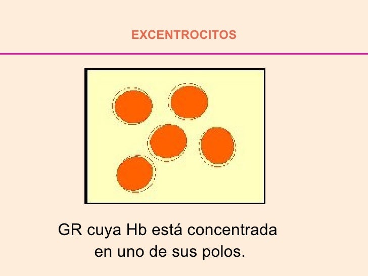 Inclusiones citoplasmaticas y alteraciones morfologicas