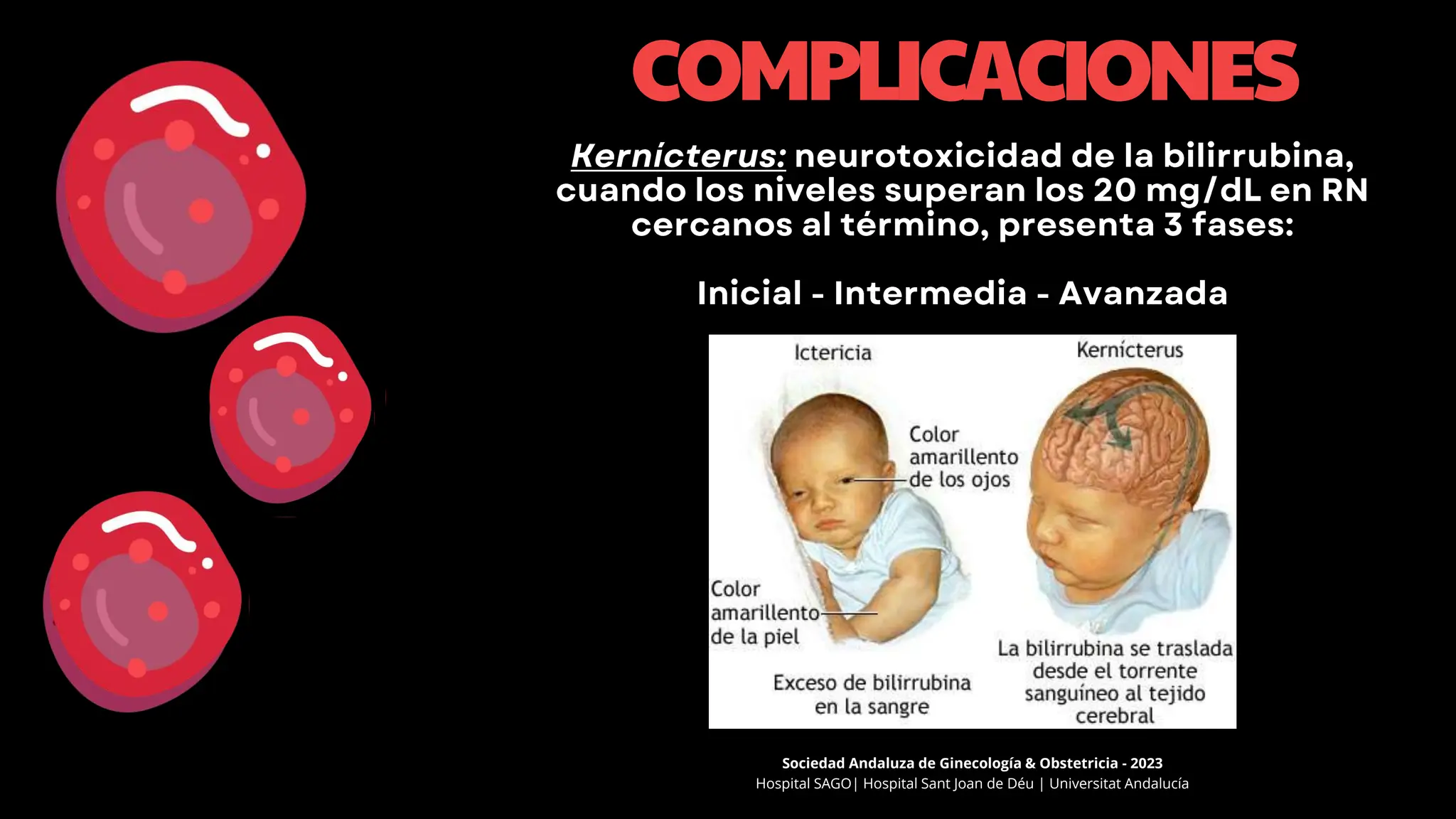 Riesgo de Incompatibilidad & Isoinmunizacion.pptx