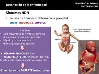 Incompatibilidad rh materno fetal | PDF