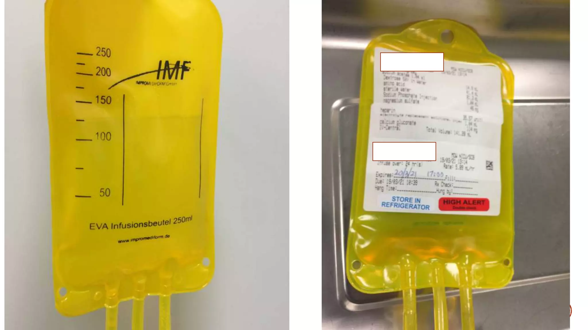 Incompatibilities of tpn & iv admixures | PPTX