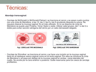 Incompetencia cervical | PPTX
