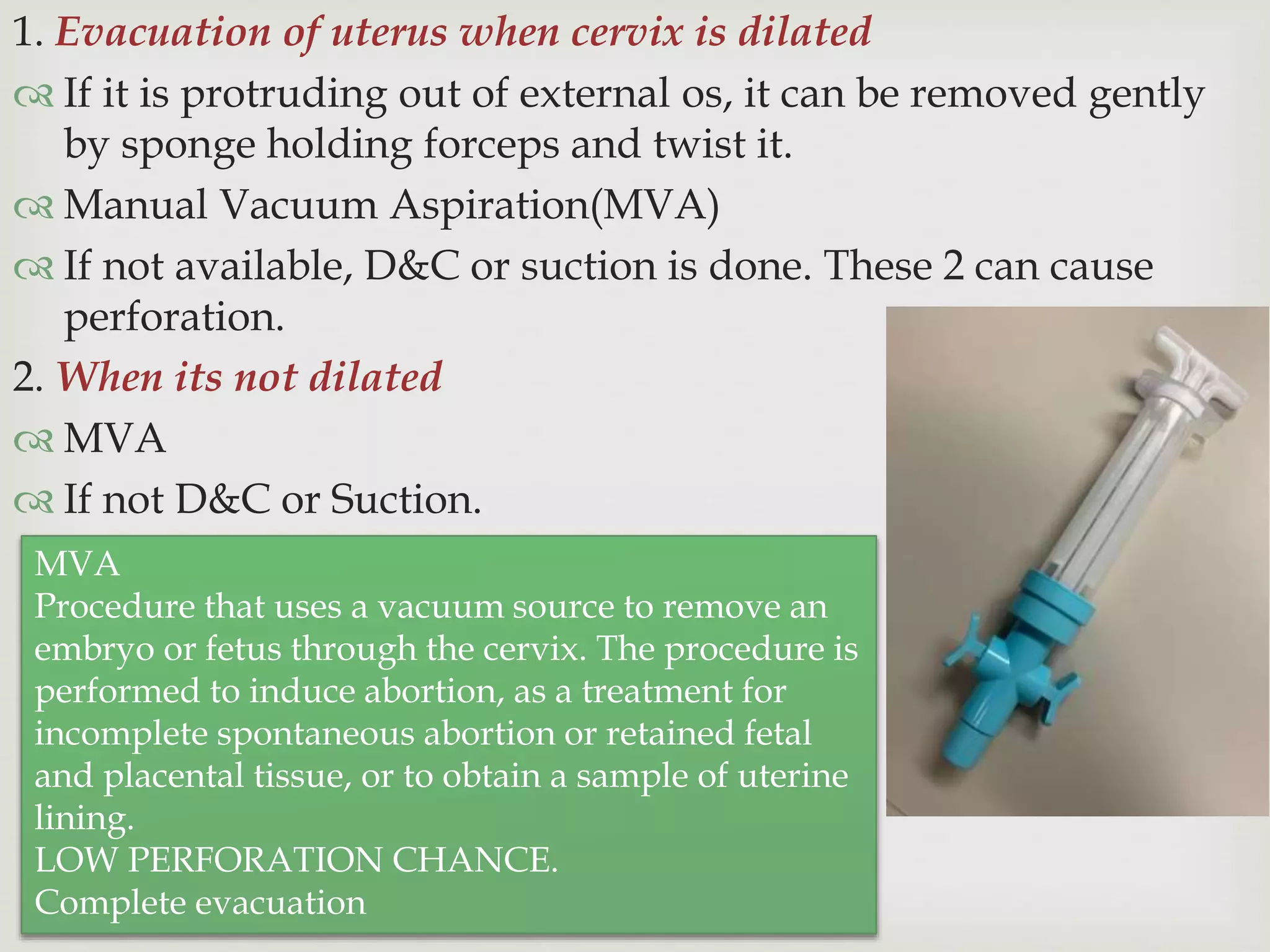 Incomplete Abortion | PPTX