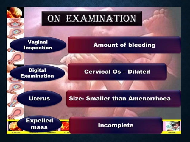 Incomplete abortion | PPTX