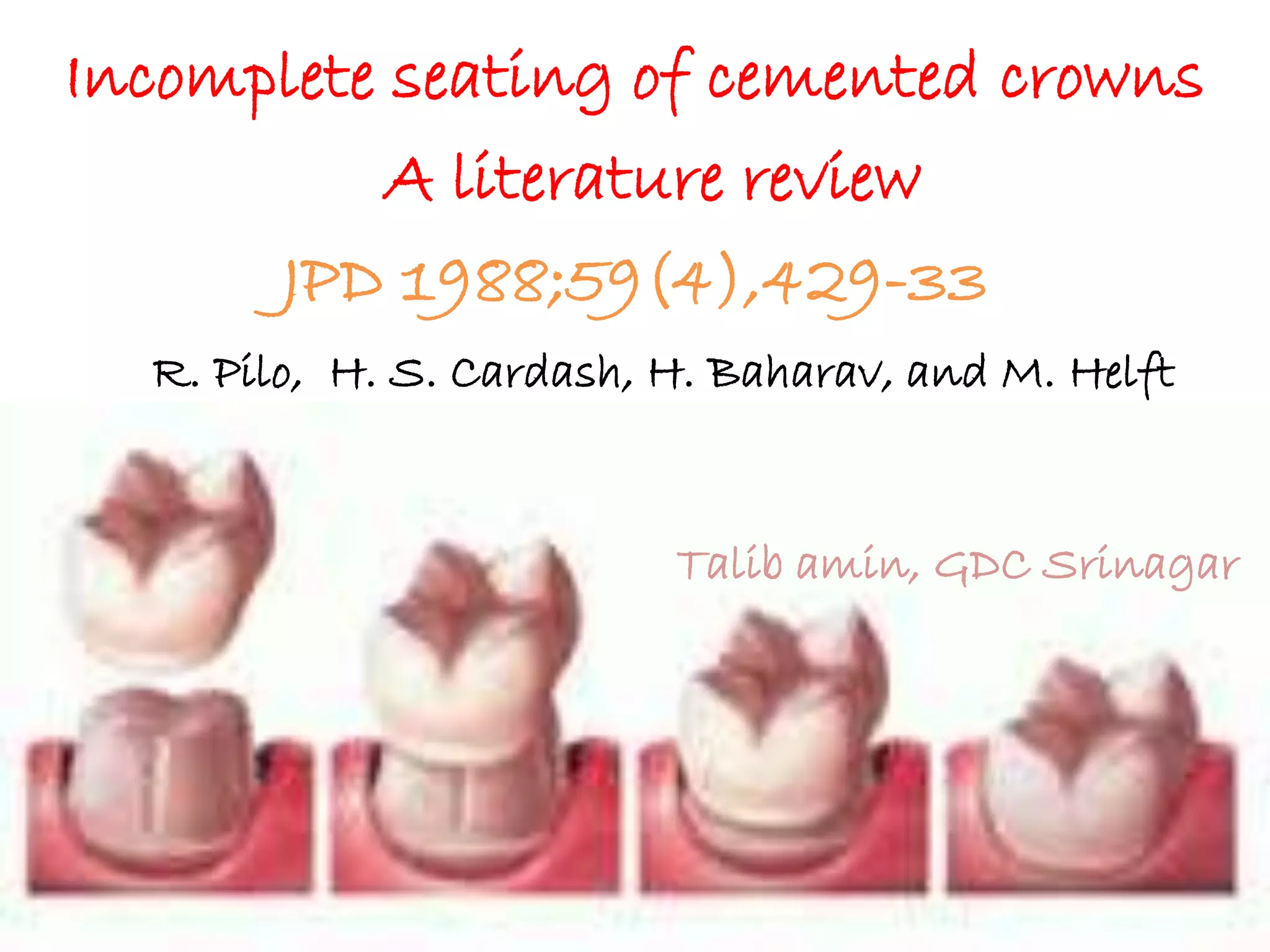 Incomplete seating of cement crowns | PPTX