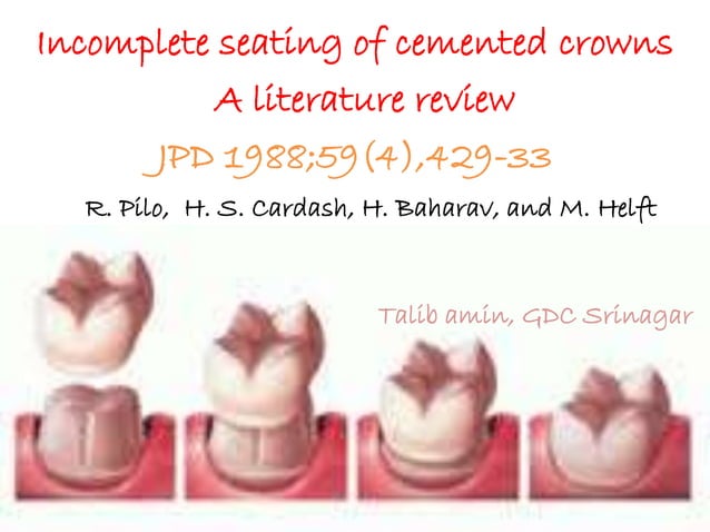 Incomplete seating of cement crowns | PPTX | Dental Health | Diseases and Conditions
