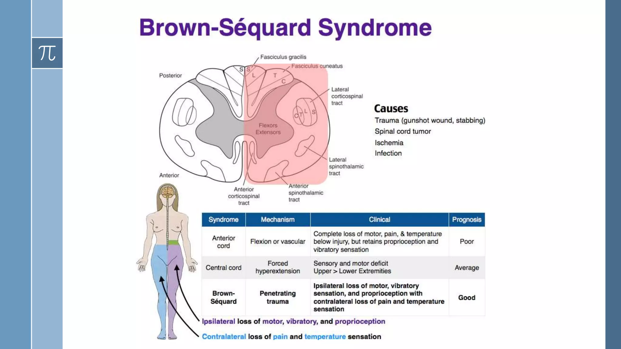 Incomplete spinal cord injury | PPT