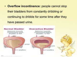 Incontinence | PPT | Sexual Conditions | Sexual Health