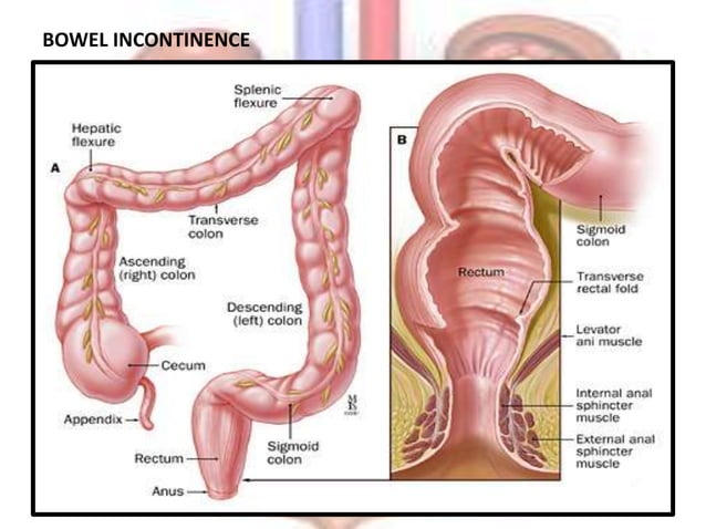 Incontinence bowel and bladder | PPTX | Sexual Conditions | Sexual Health