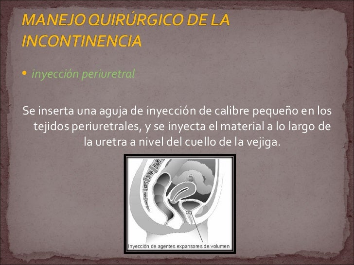 Incontinencia urinaria