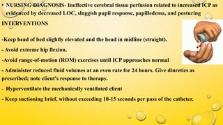 Increased icp | PPTX