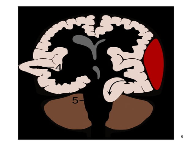 Increased intracranial pressure | PPT
