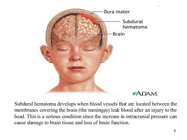 Increased Intracranial Pressure Intracranial Pressure