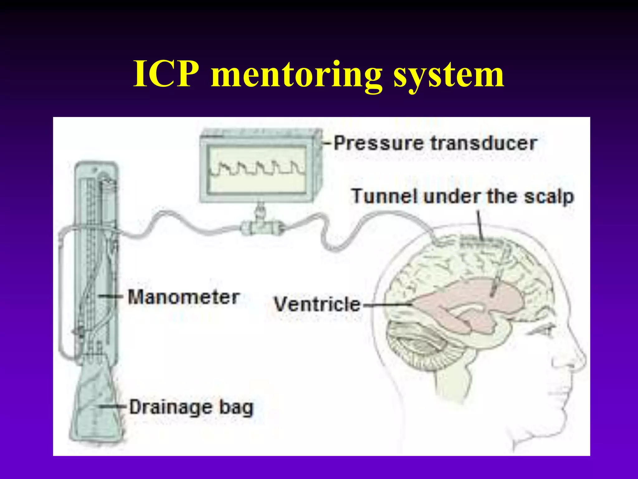 Increase ICP .ppt