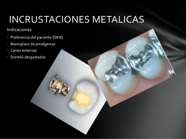 Incrustaciones metalicas