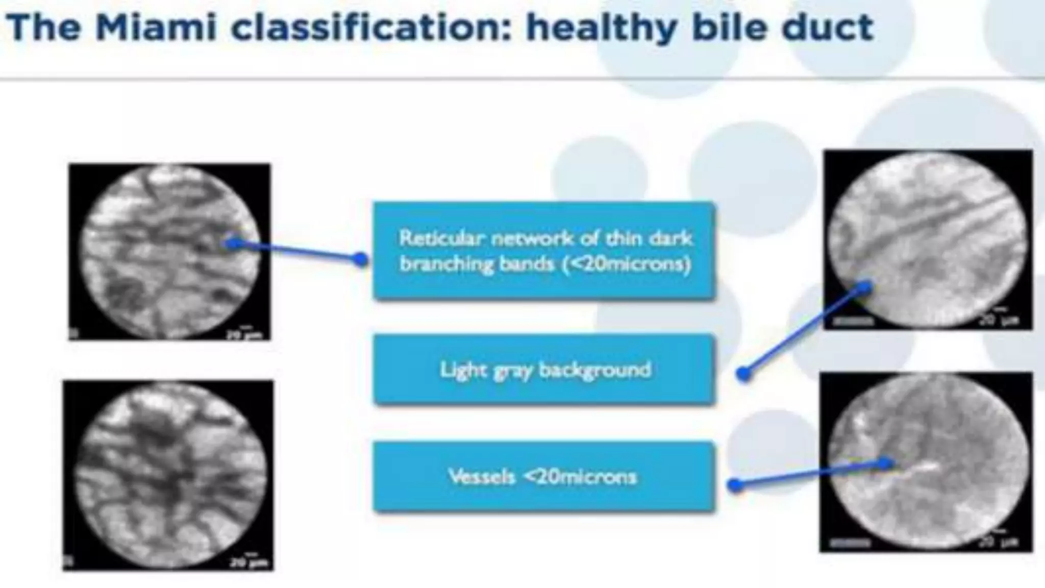 Indeterminate biliary stricture | PPTX