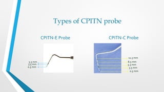 INDEX CPITN, DMFT & DMFS | PDF