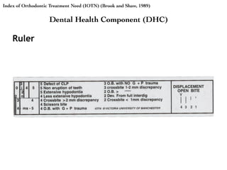 Index of Orthodontic Treatment Need (IOTN) | PDF