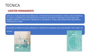 INDICACION DE TORACOSTOMIA Y COLOCACIÓN DE SONDA ENDOPLEURAL.pptx