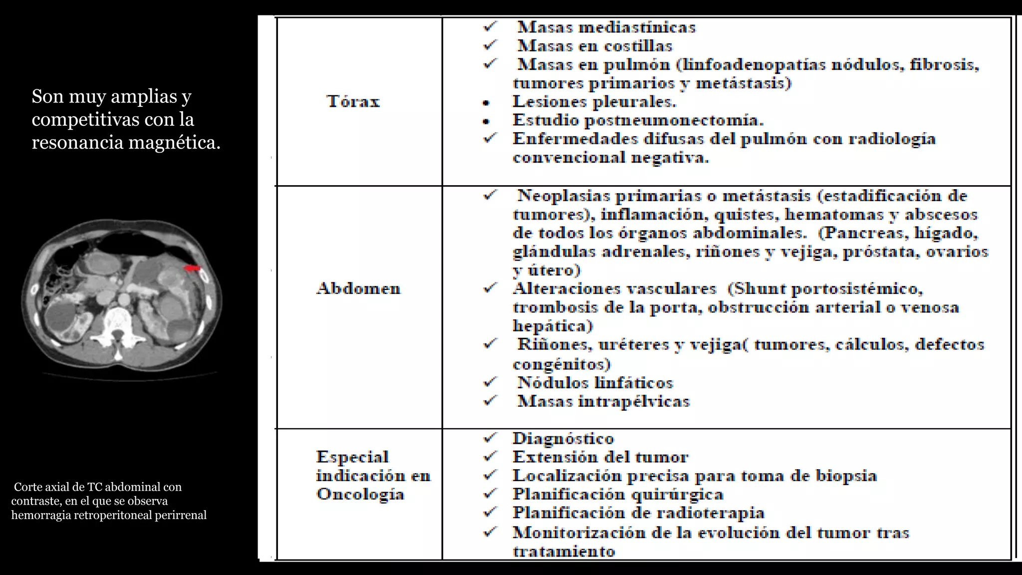 Indicaciones de la tac | PPTX