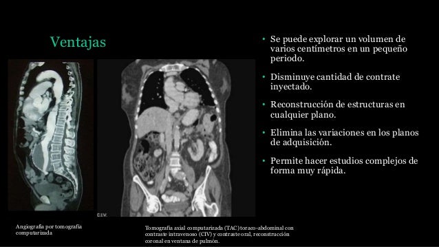 Indicaciones de la tac