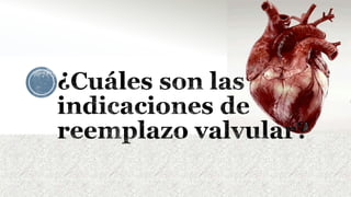 Indicaciones para Cirugía de Reemplazo Valvular Aórtico | PPTX