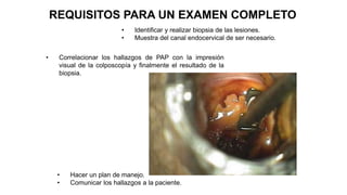 INDICACIONES PARA COLPOSCOPIA.pptx