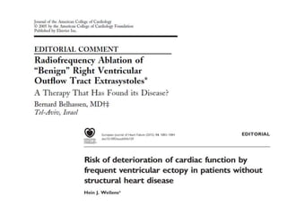Indicaciones para la ablación de extrasistolia ventricular | PPTX