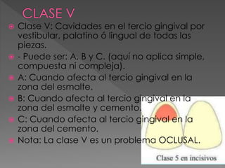 Indicaciones para resinas dentales | PPTX