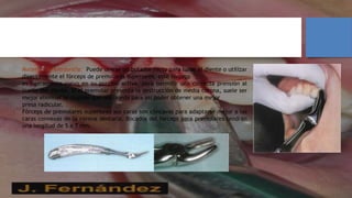 Indicaciones y contraindicaciones de exodoncia simple. técnica de ...