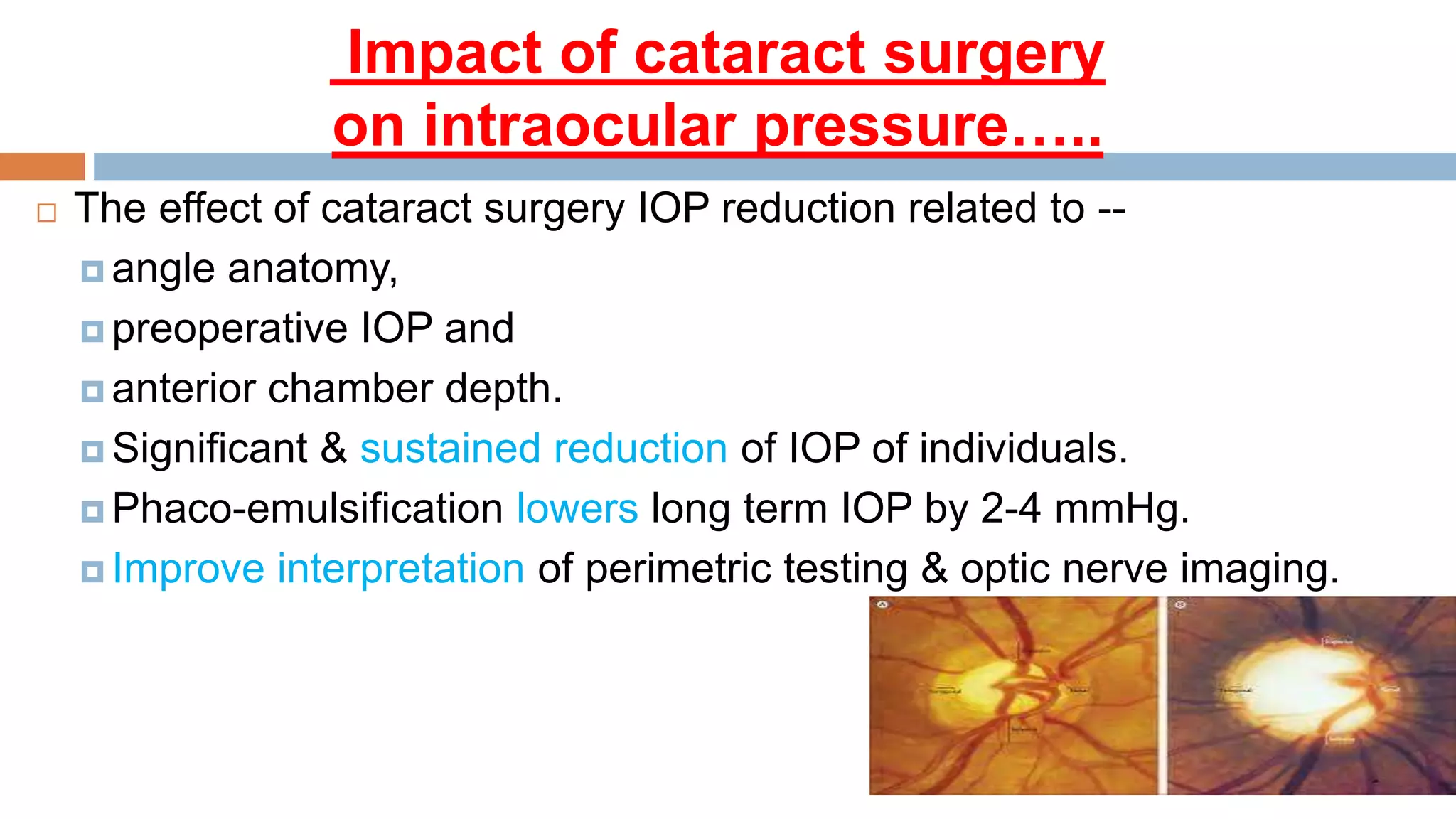 Indication Of Combined Cataract And Glaucoma Surgery Pptx