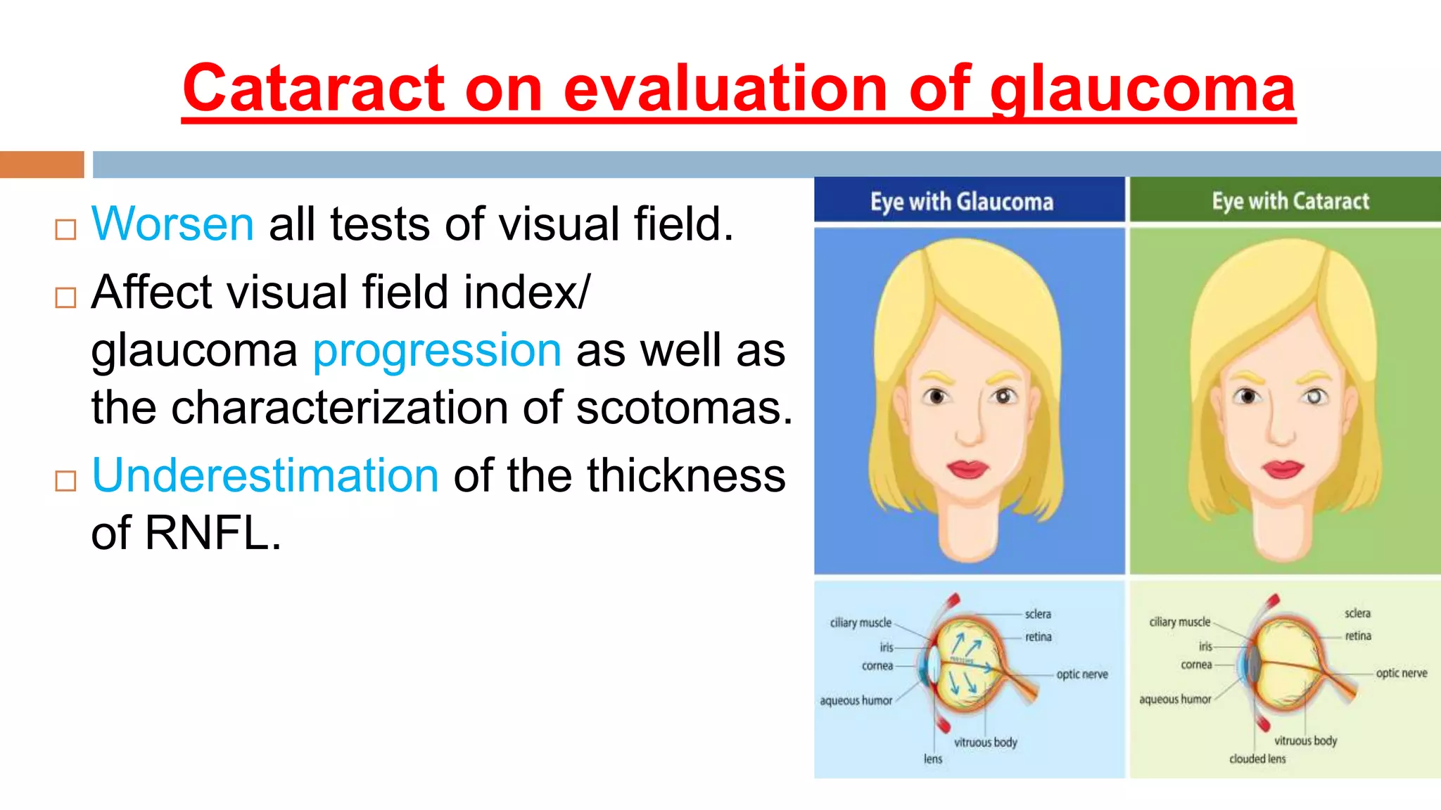 Indication of combined cataract & glaucoma surgery .pptx
