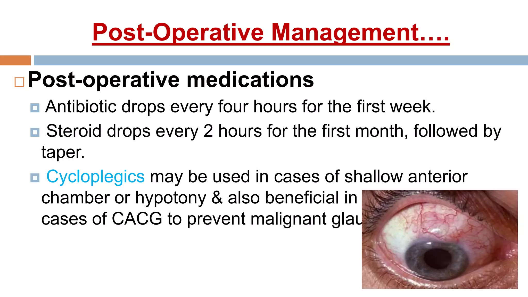 Indication of combined cataract & glaucoma surgery .pptx