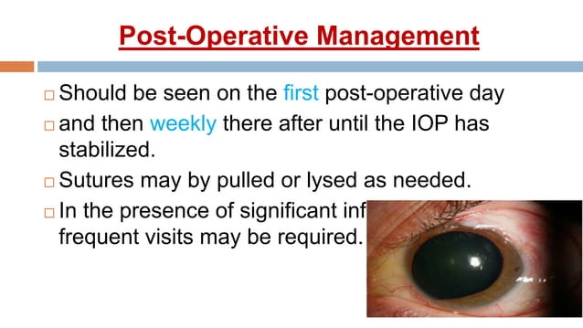 Indication of combined cataract & glaucoma surgery .pptx