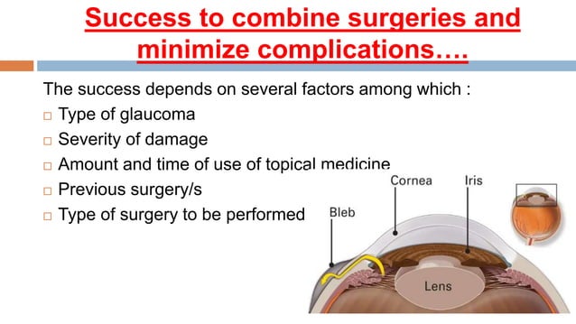 Indication of combined cataract & glaucoma surgery .pptx