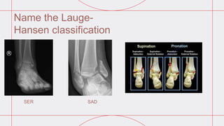 Indications - Ankle fx.pptx