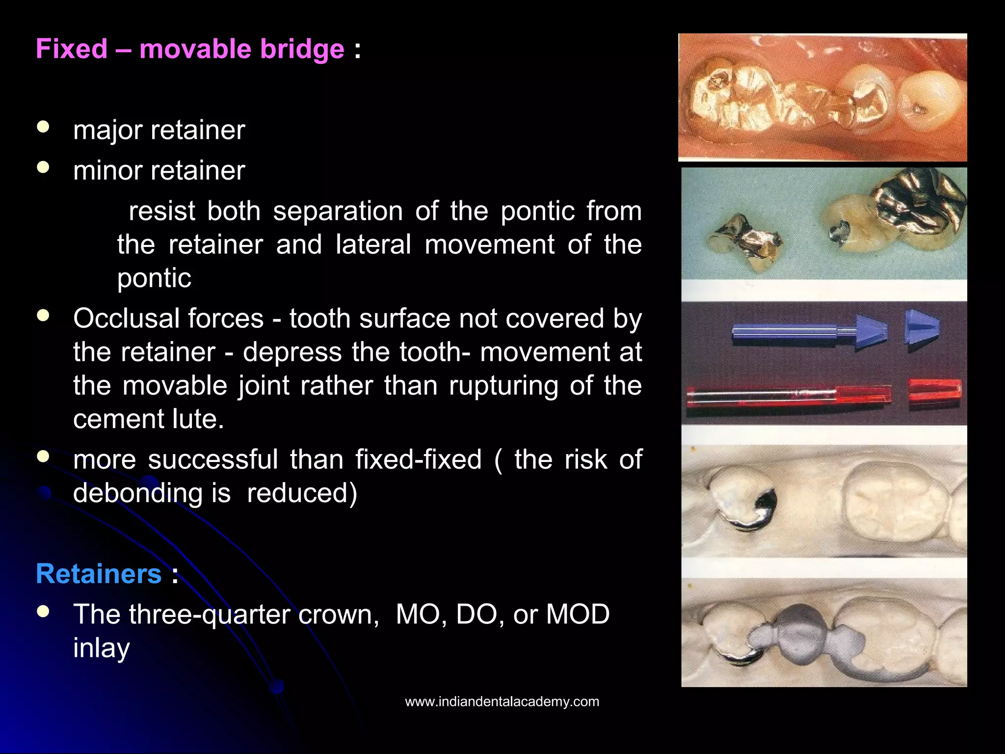 Indications contraindications and classification of bridges/endodontic ...