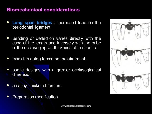 Indications contraindications and classification of bridges/endodonti…