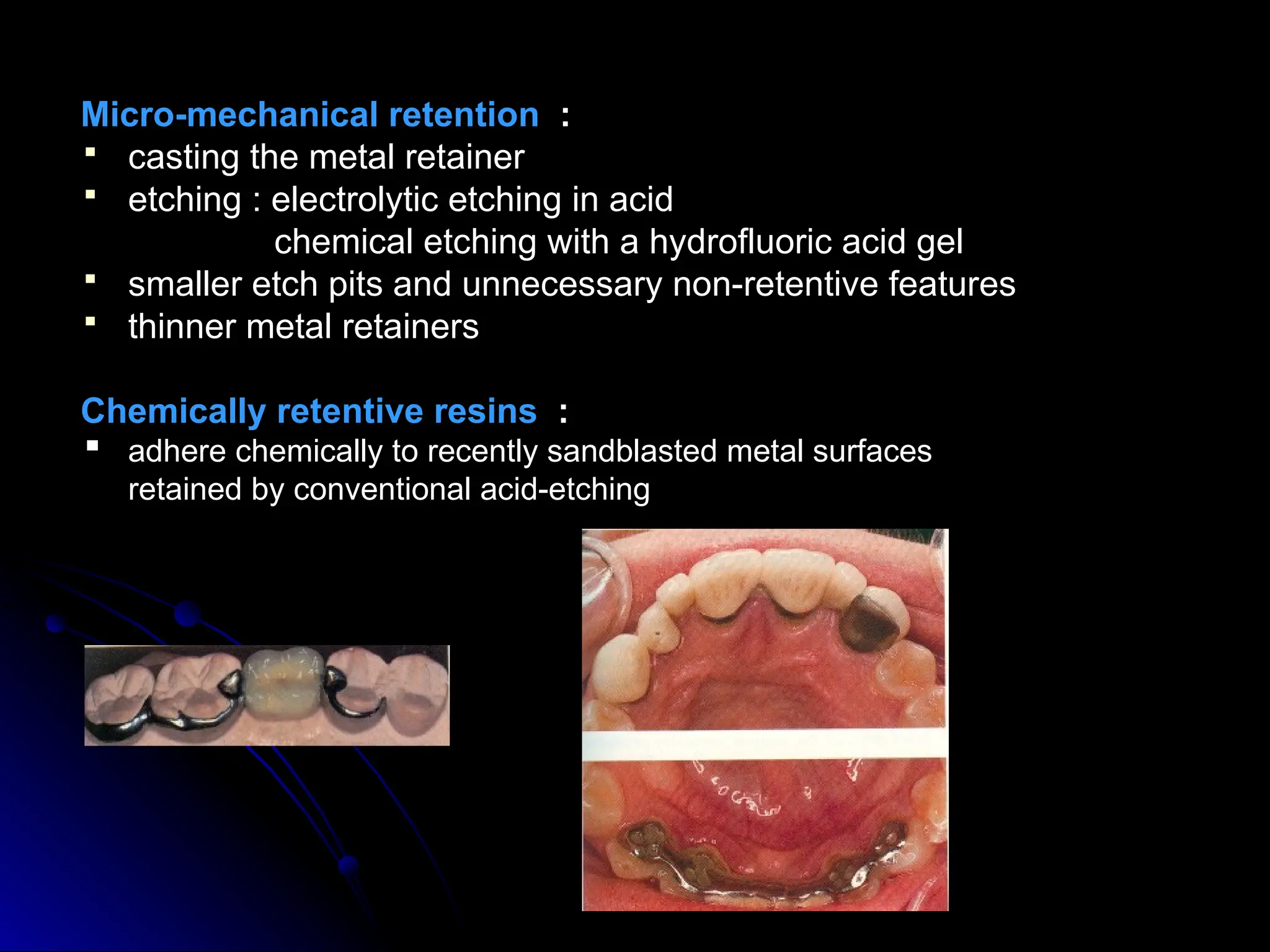 Indications Contraindications and Classification of Bridges 2.pptx